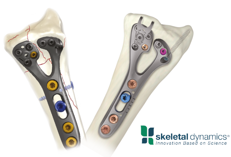 LEDA Orthopaedics - Market leading orthopaedic distributor and agent in ...