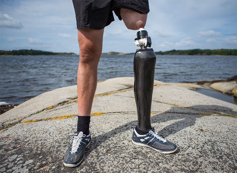 Integrum Osseointegration Hand and Wrist - LEDA